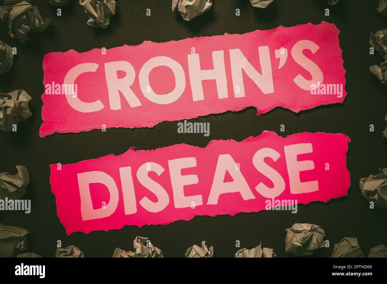 Conceptual display Crohn S Is Disease, Conceptual photo the chronic ...