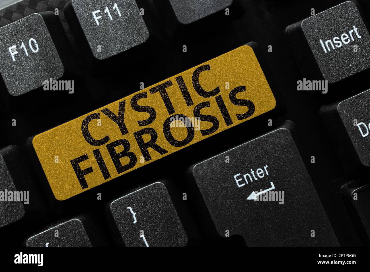 Text showing inspiration Cystic Fibrosis, Internet Concept a hereditary ...