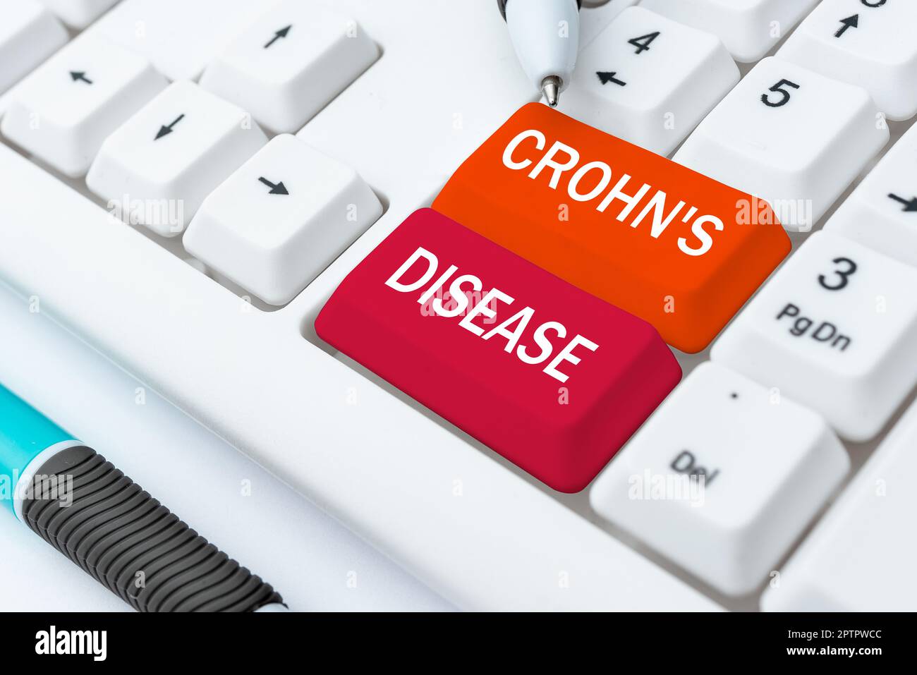 Hand writing sign Crohn S Is Disease, Business approach the chronic ...