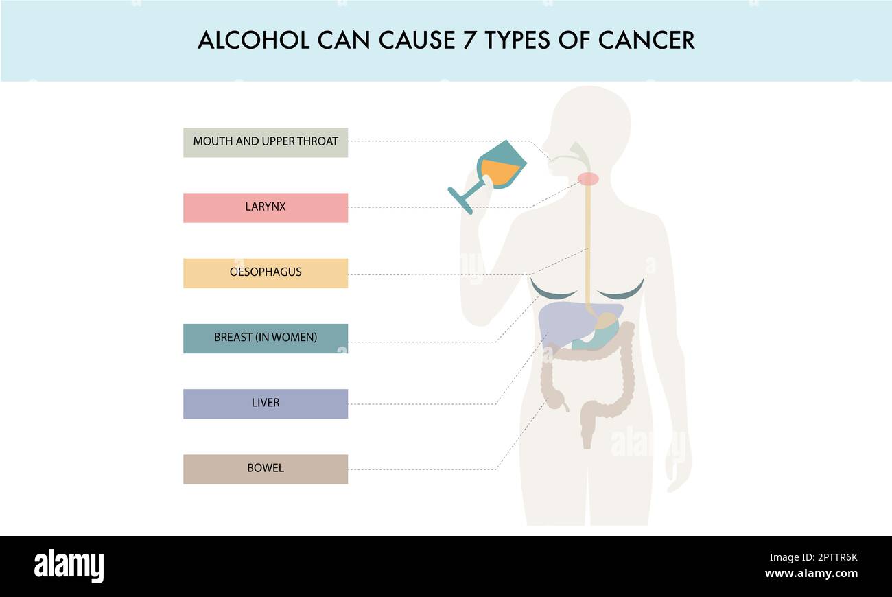 Alcohol and cancer Stock Photo - Alamy