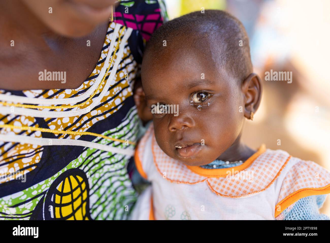 Mother and young child admitted to hospital for malnutrition and ...
