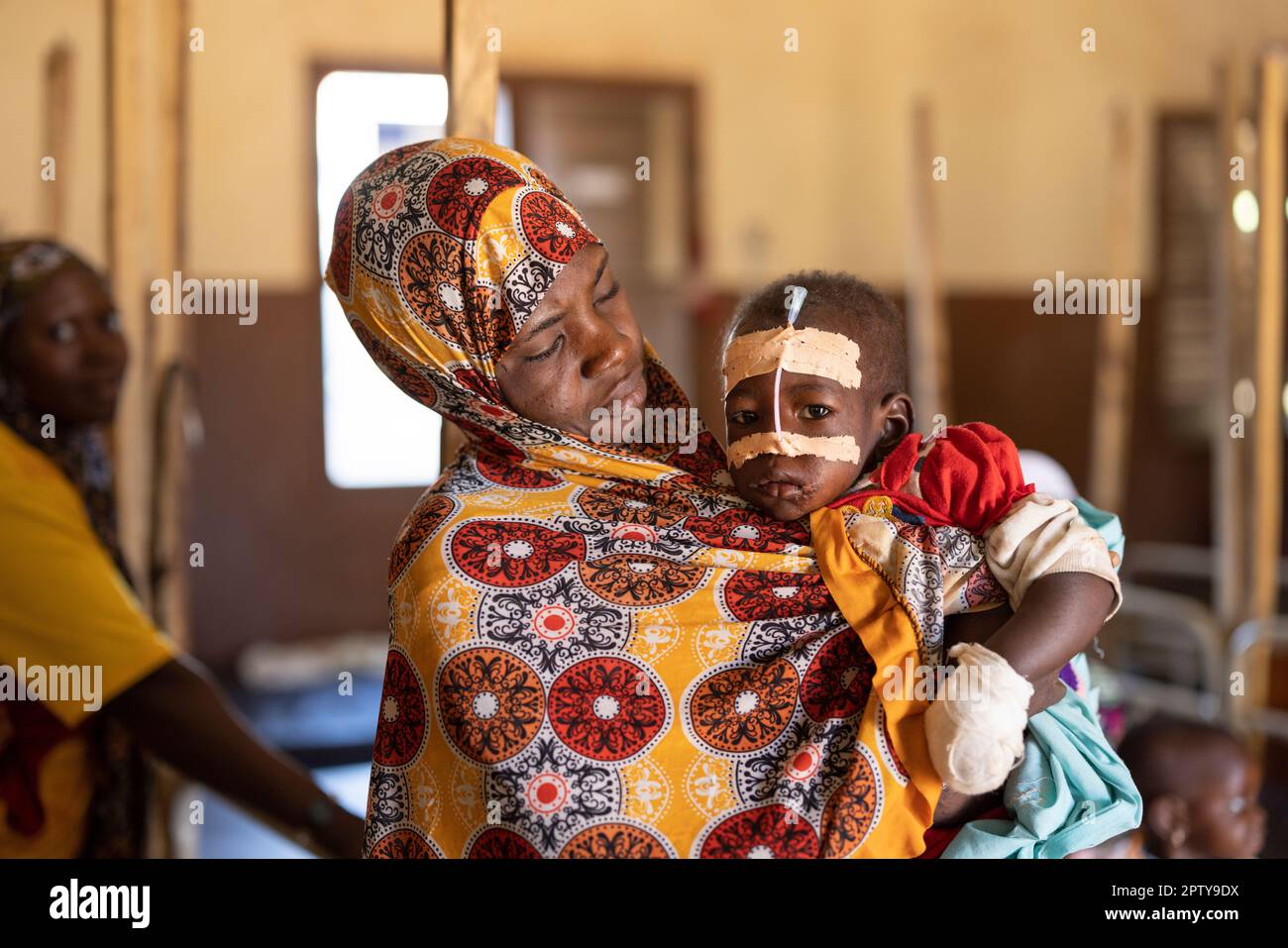 Mother and young child admitted to hospital for malnutrition and ...