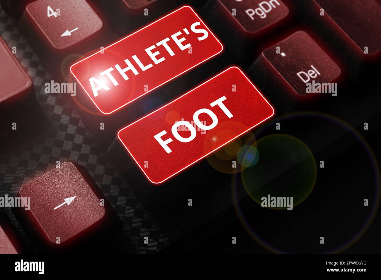 Writing displaying text Athlete's Foot, Word for a fungus infection of ...