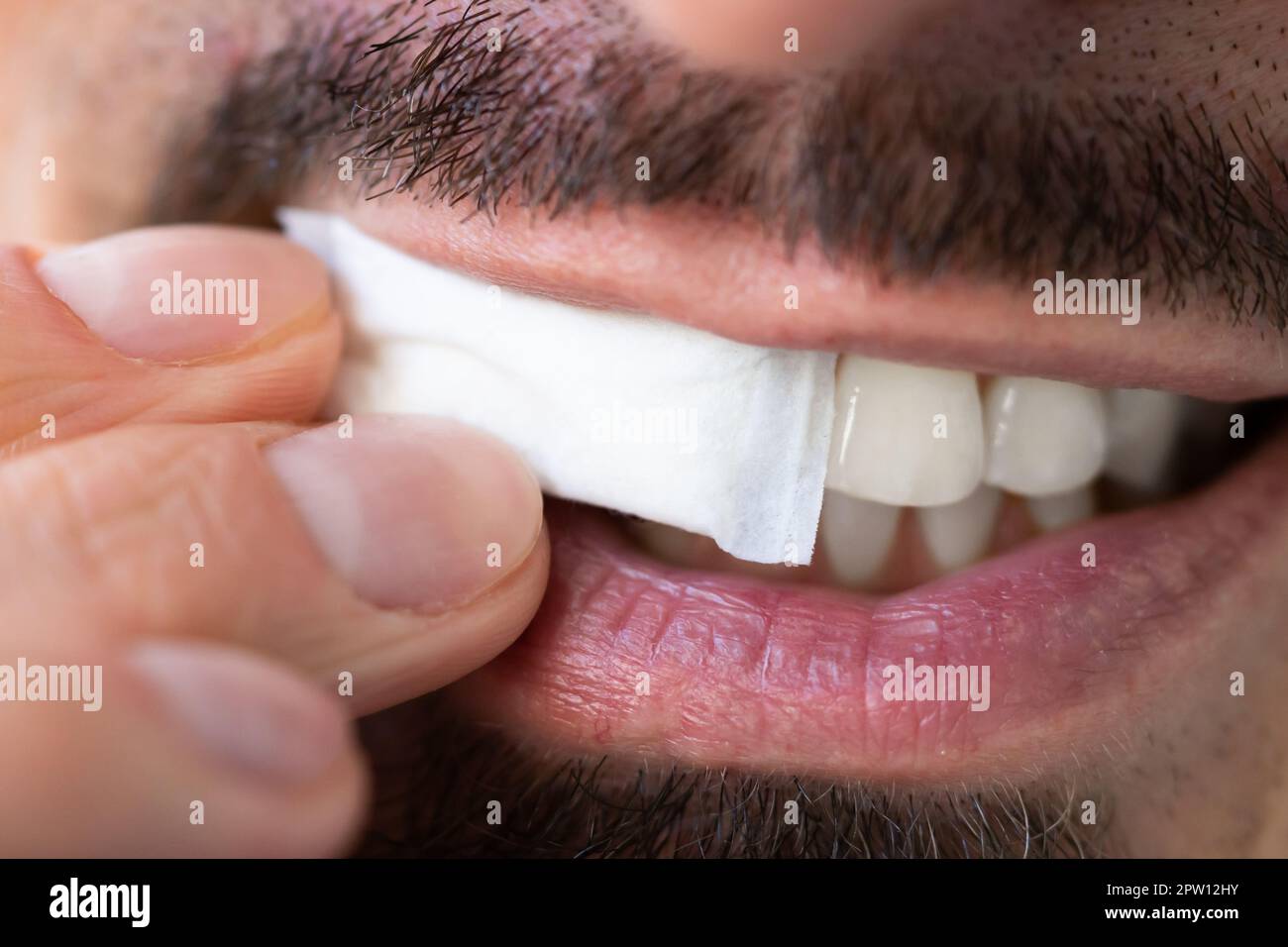 Man Chewing Wet Moist Nicotine Tobacco Snus Product Stock Photo - Alamy
