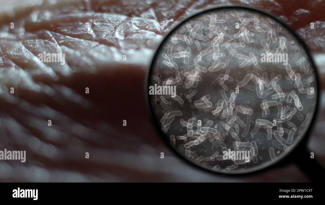 Searching for bacteria on human skin Stock Photo - Alamy
