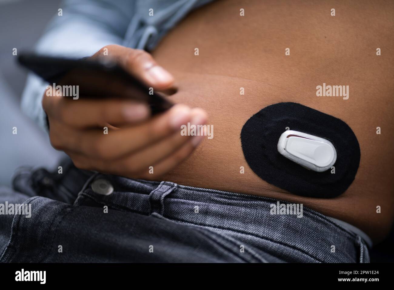 Man Testing Glucose Level With Continuous Glucose Monitor On Mobile ...