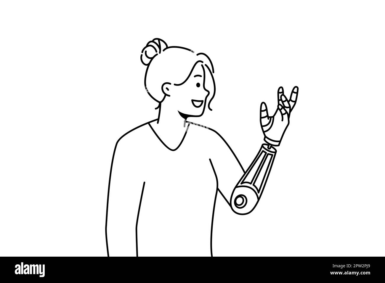 Smiling young woman with bionic arm. Happy female with prosthesis ...