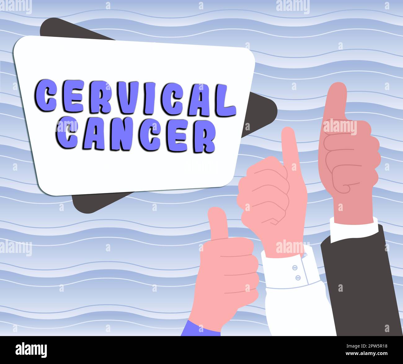Handwriting text Cervical Cancer, Conceptual photo type of cancer that ...