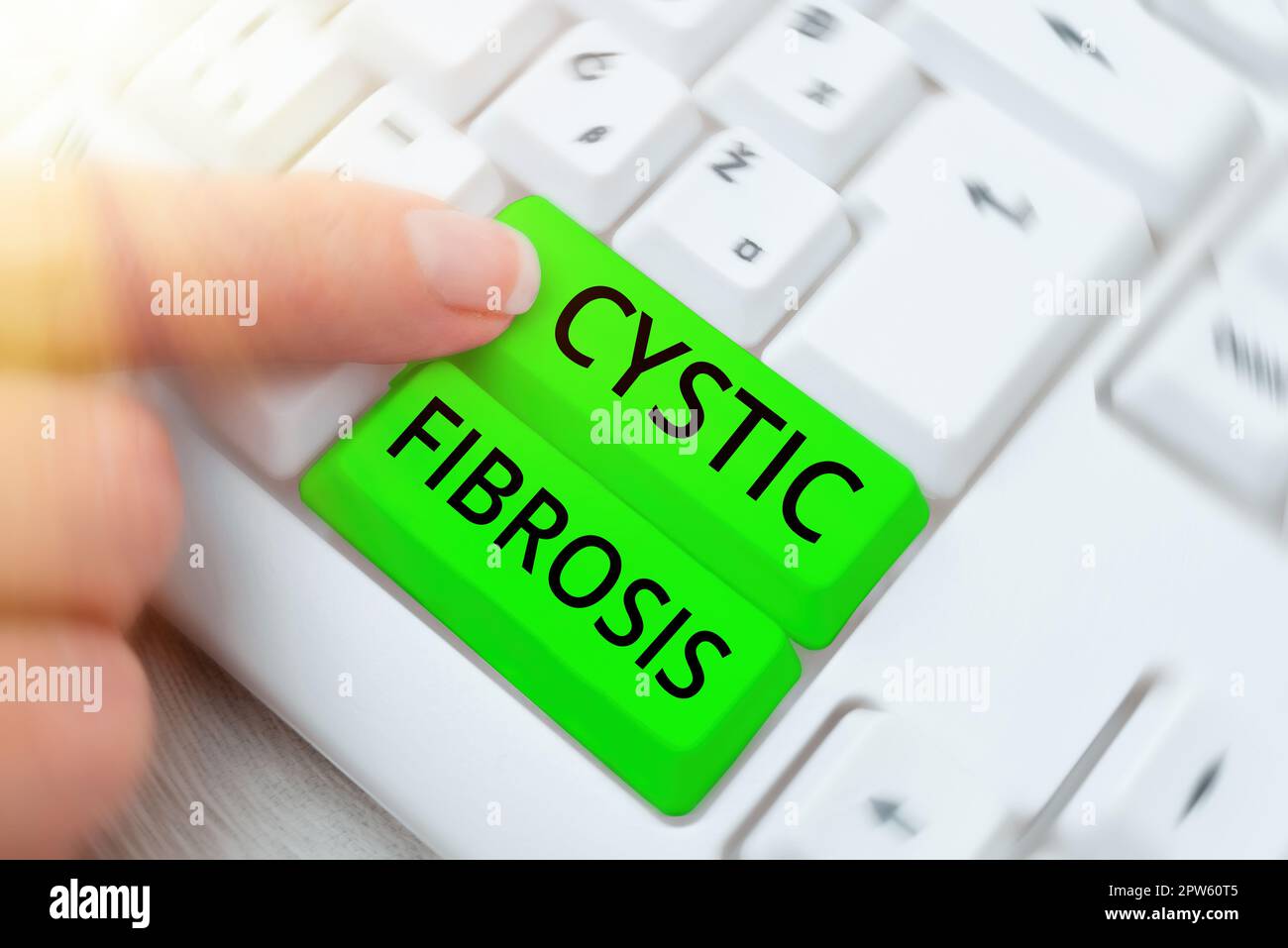 Sign displaying Cystic Fibrosis, Internet Concept a hereditary disorder ...