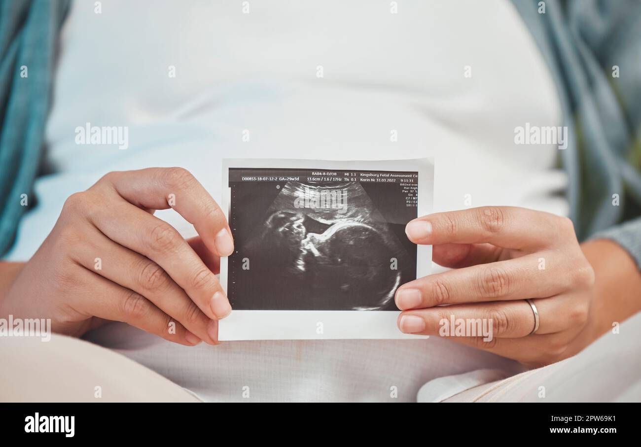 3d baby scan hi-res stock photography and images - Alamy