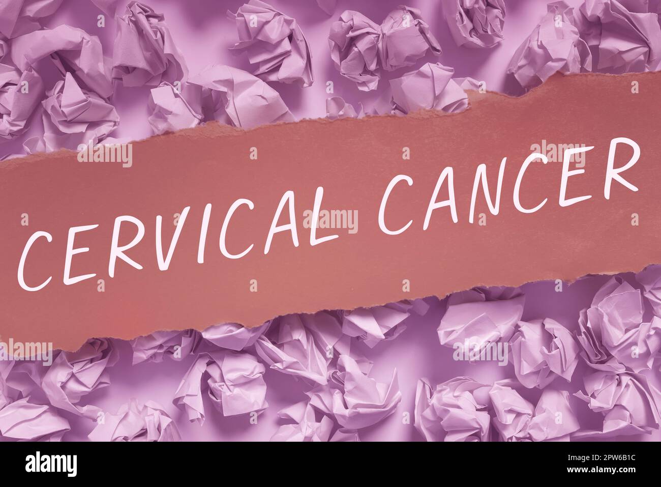 Conceptual display Cervical Cancer, Business concept type of cancer ...