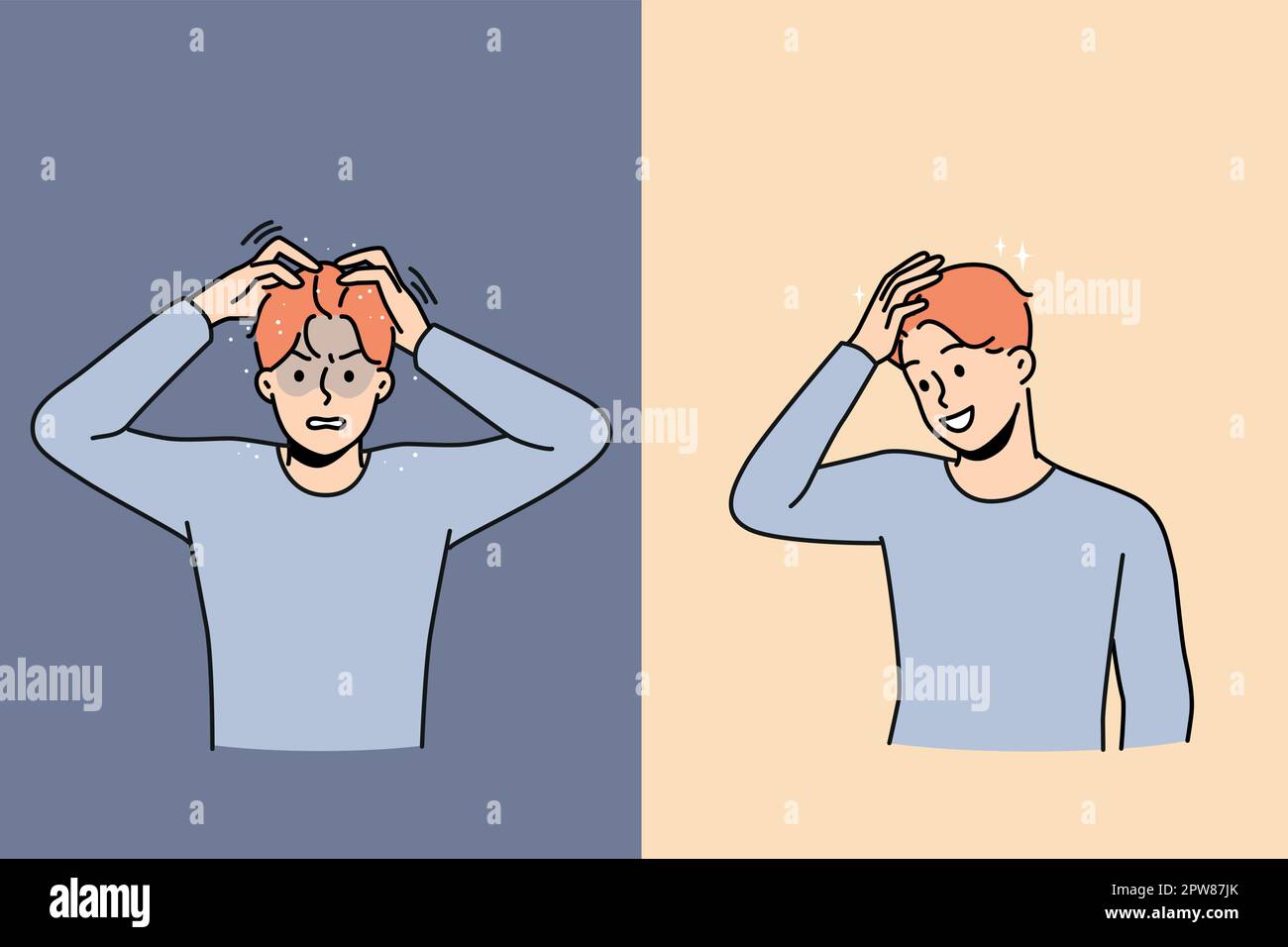 Young man before and after dandruff treatment Stock Vector Image & Art ...