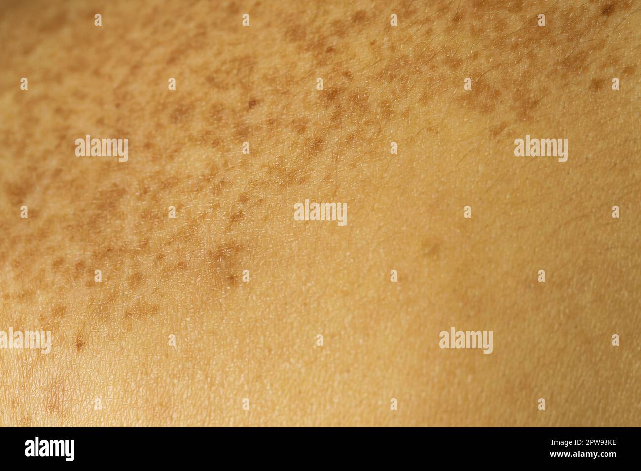 Texture of human skin as background, closeup view Stock Photo - Alamy