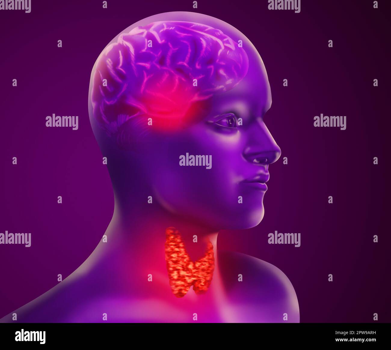 Illustration of human with inflamed thyroid gland on color background ...
