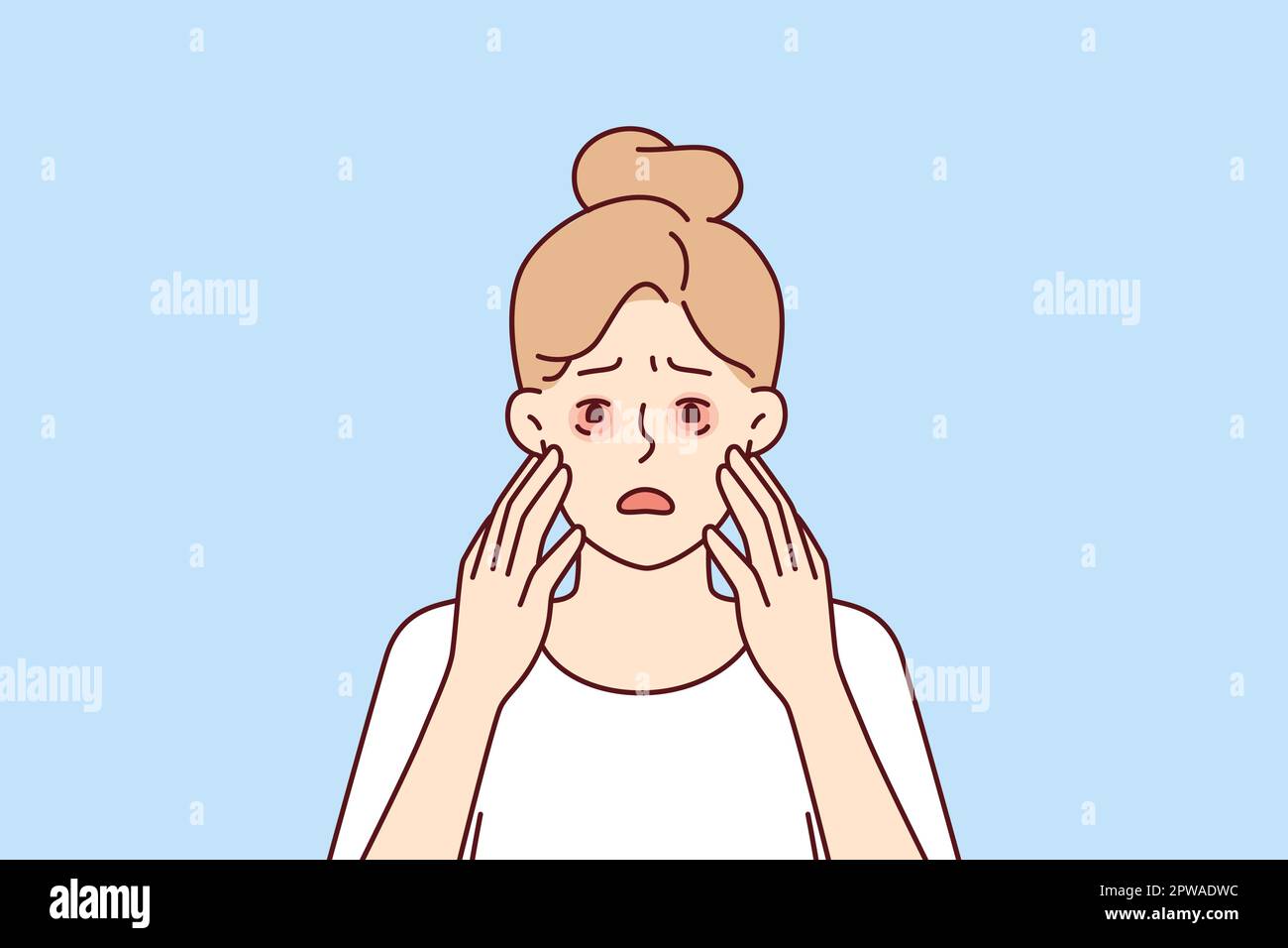 Sad woman with dry reddened eyes due to irritation or allergic reaction ...