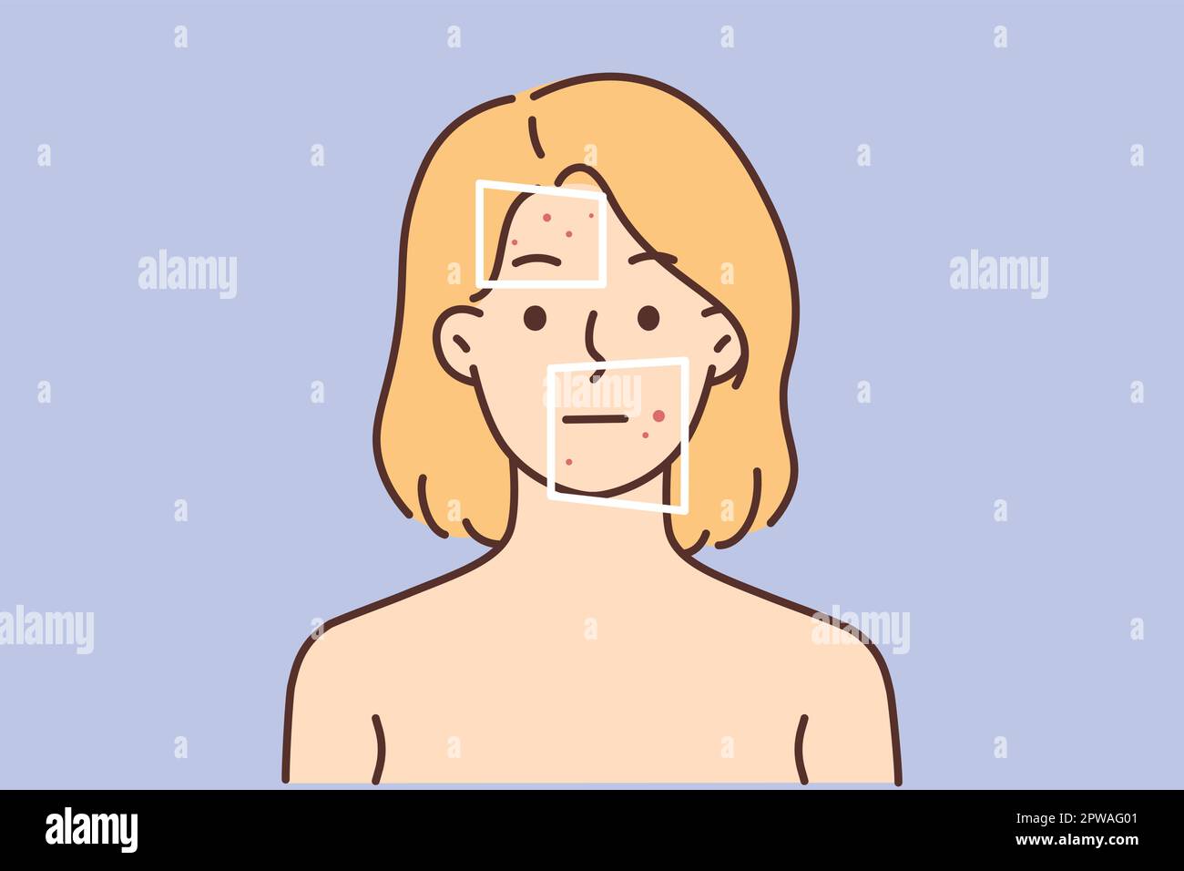 Unhealthy Moisture Stock Vector Images Alamy unhealthy-moisture-stock-vector-images-alamy