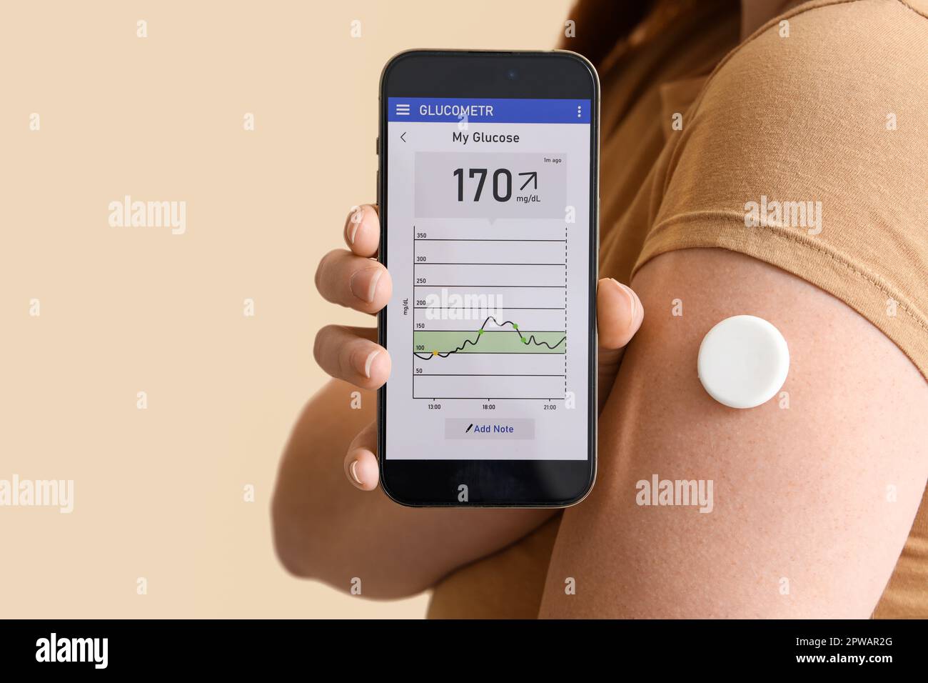 Woman with glucose sensor using mobile phone for measuring blood sugar ...