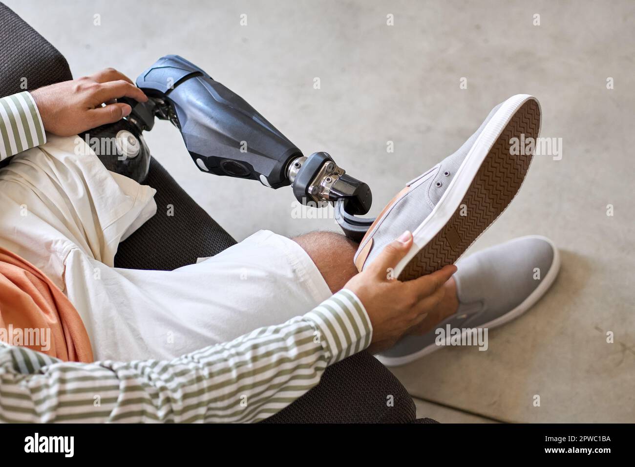 Amputee man with above knee leg prosthesis sitting on sofa wearing shoe ...