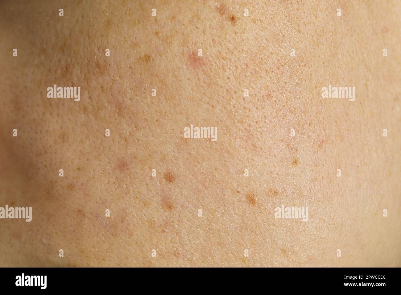 Texture of human skin as background, closeup view Stock Photo - Alamy