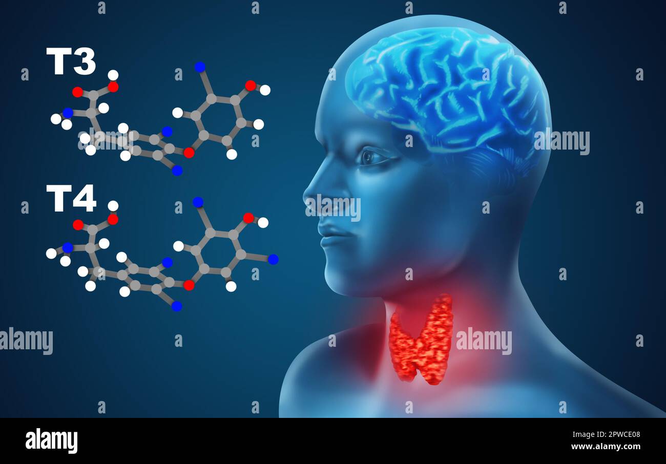 Illustration of human with inflamed thyroid gland on color background ...