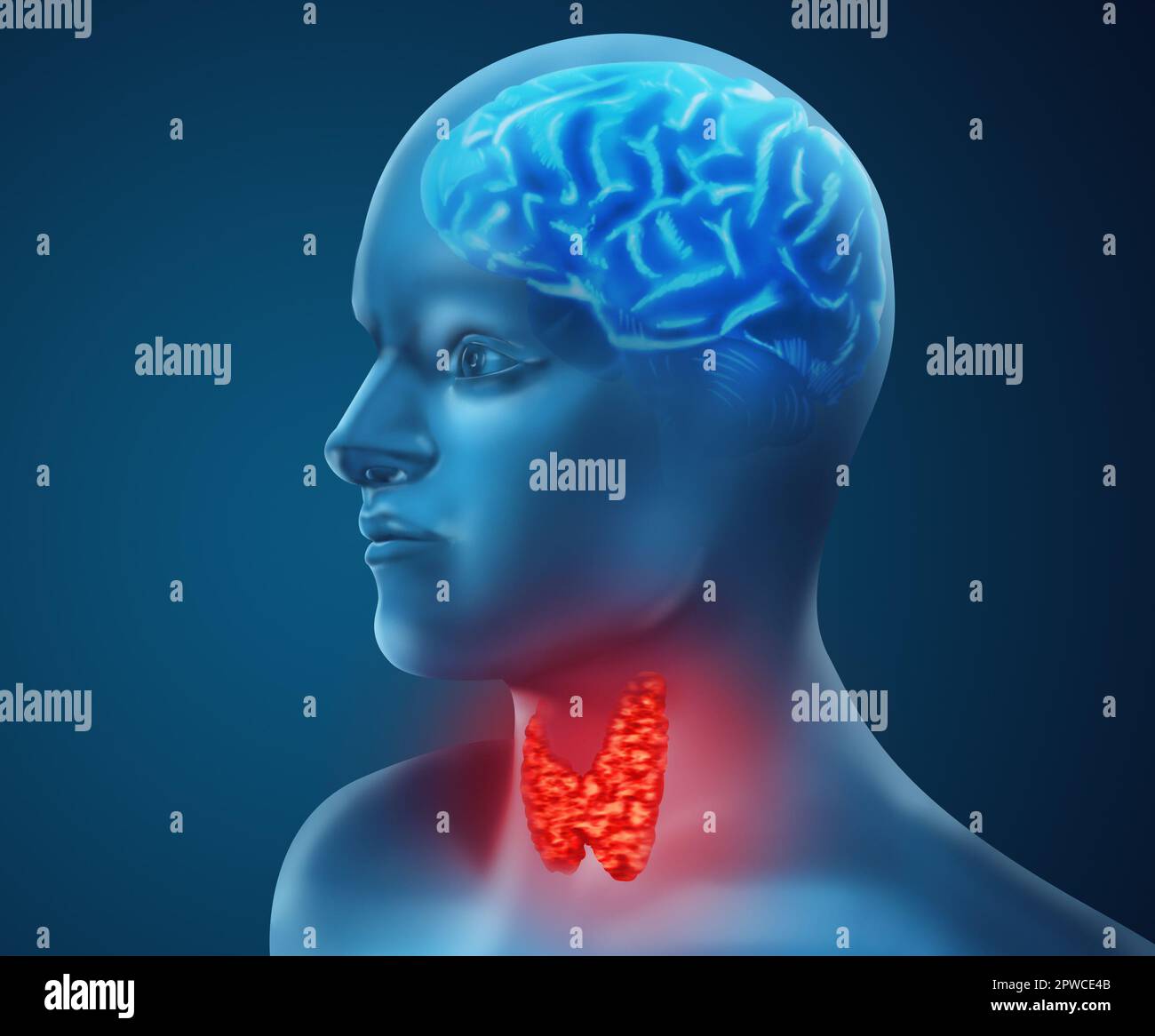 Illustration of human with inflamed thyroid gland on color background ...