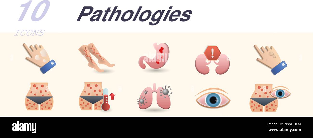 Pathologies set. Creative icons: vitiligo, varicose, ulcers, uremia ...