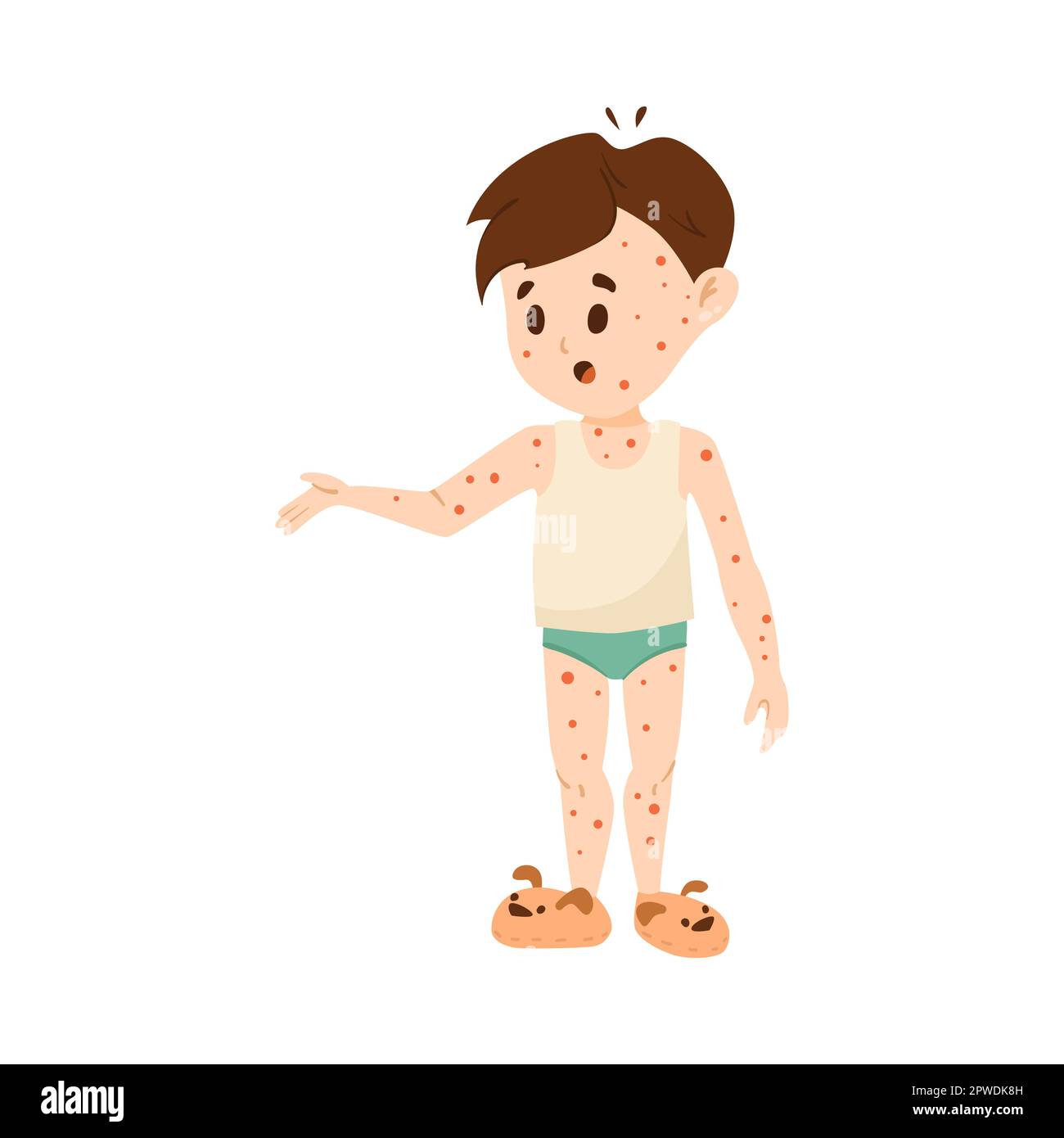 Sad sick boy with chicken pox cartoon illustration Stock Vector Image ...