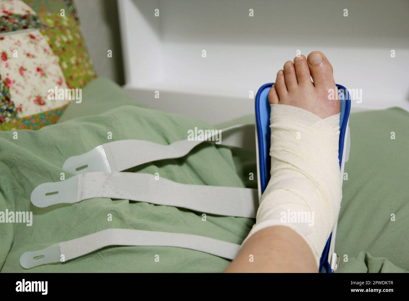 Concept of bandaging and treating an ankle injury at home Stock Photo ...