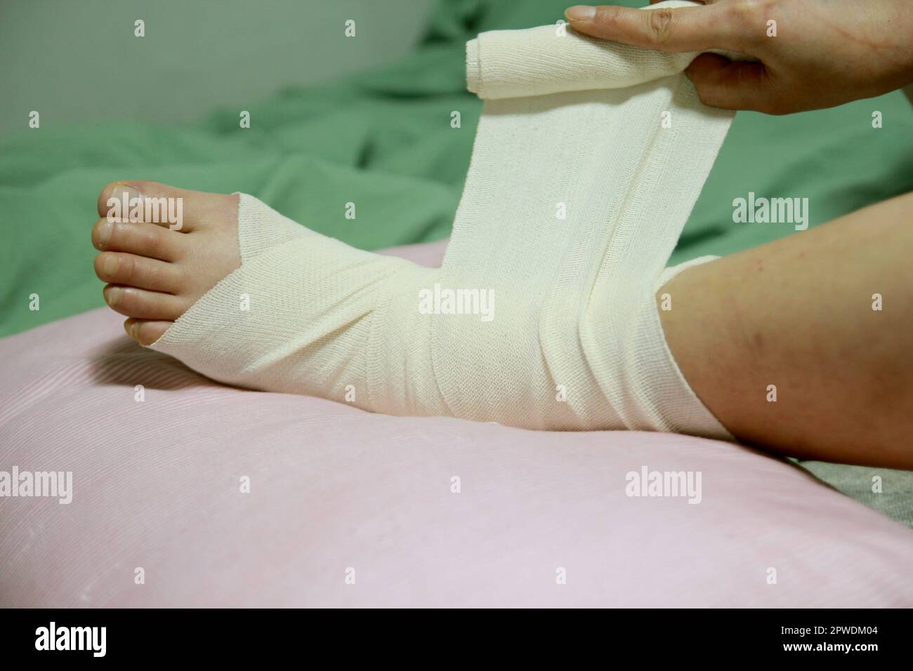 Concept of bandaging and treating an ankle injury at home Stock Photo ...