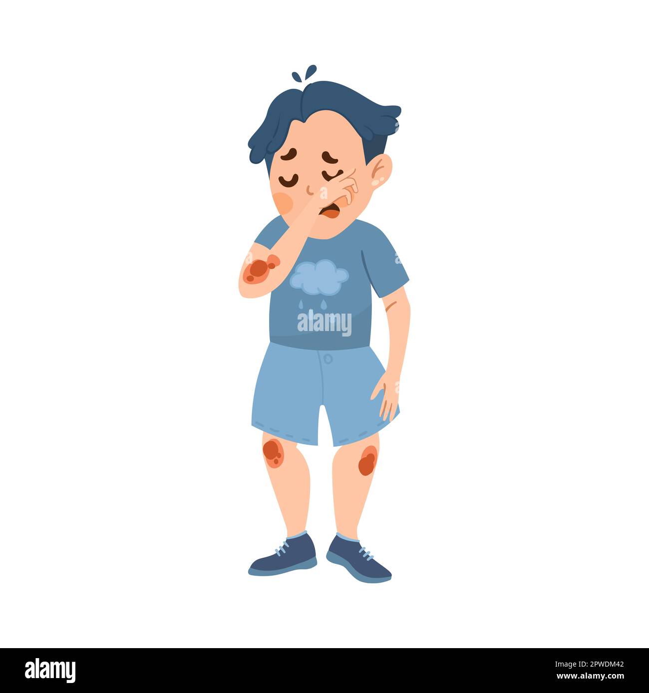Sad sick boy with eczema cartoon illustration Stock Vector Image & Art ...