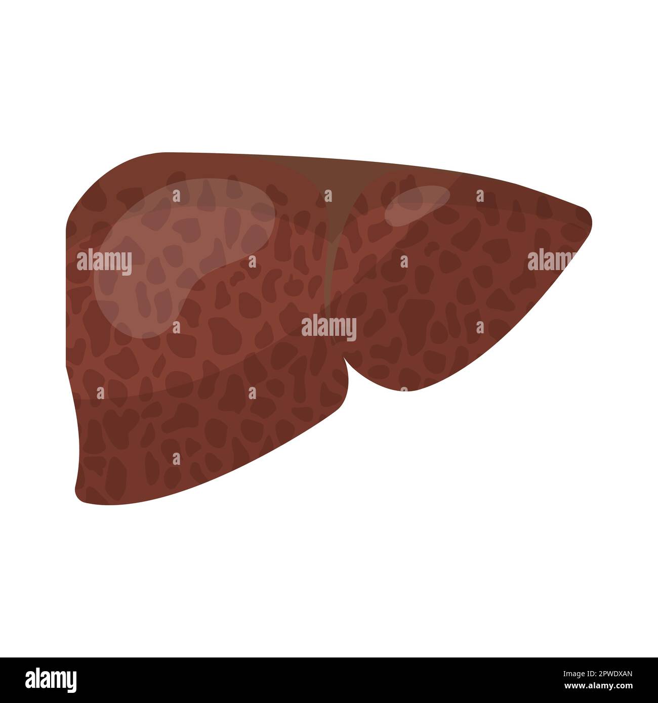 Fatty liver of sick patient cartoon illustration Stock Vector Image ...