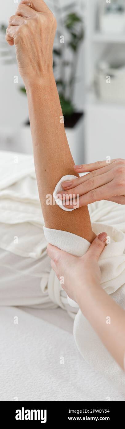 Vertical shot of dermatologist hands cleaning female arm skin applying ...