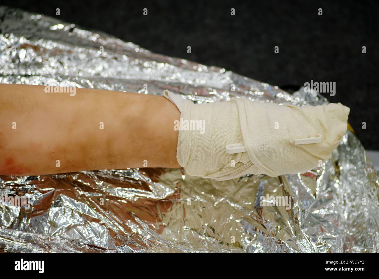 Leg mannequin of a human that allows for realistic simulation of ...