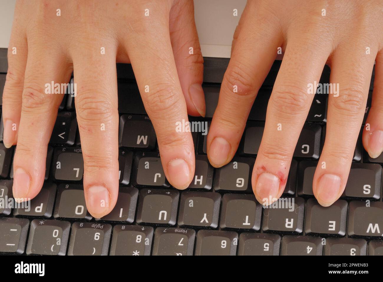 Bloody Fingers typing on a computer keyboard Stock Photo - Alamy