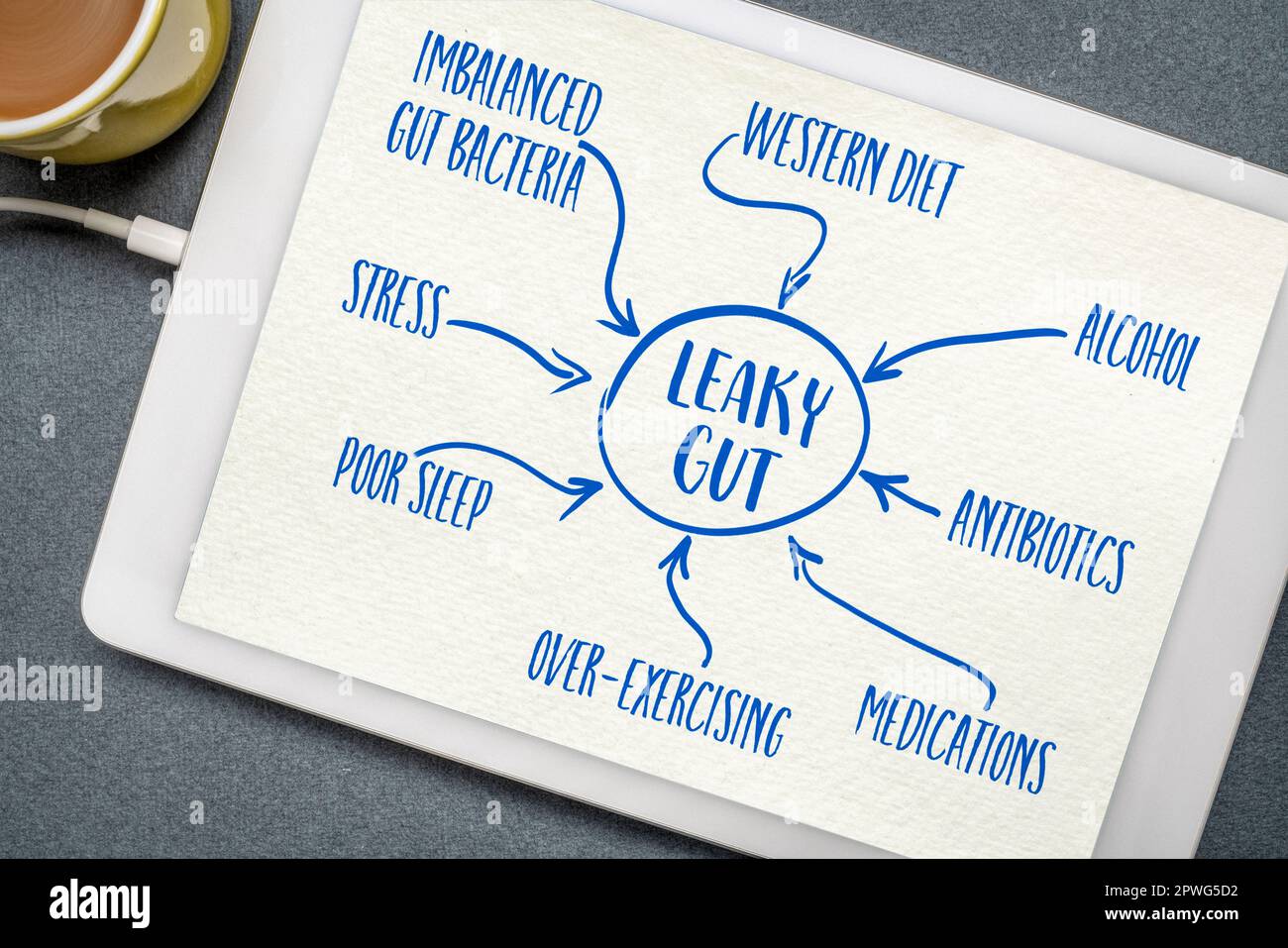 causes of leaky gut syndrome - text and drawing on a digital tablet ...