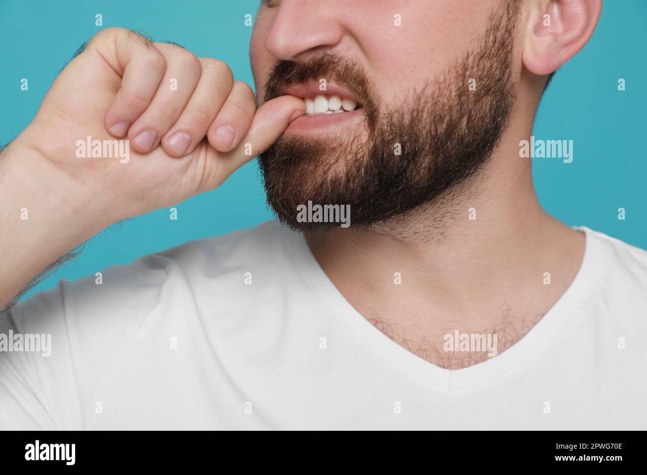 Man biting his nails on light blue background, closeup. Bad habit Stock ...