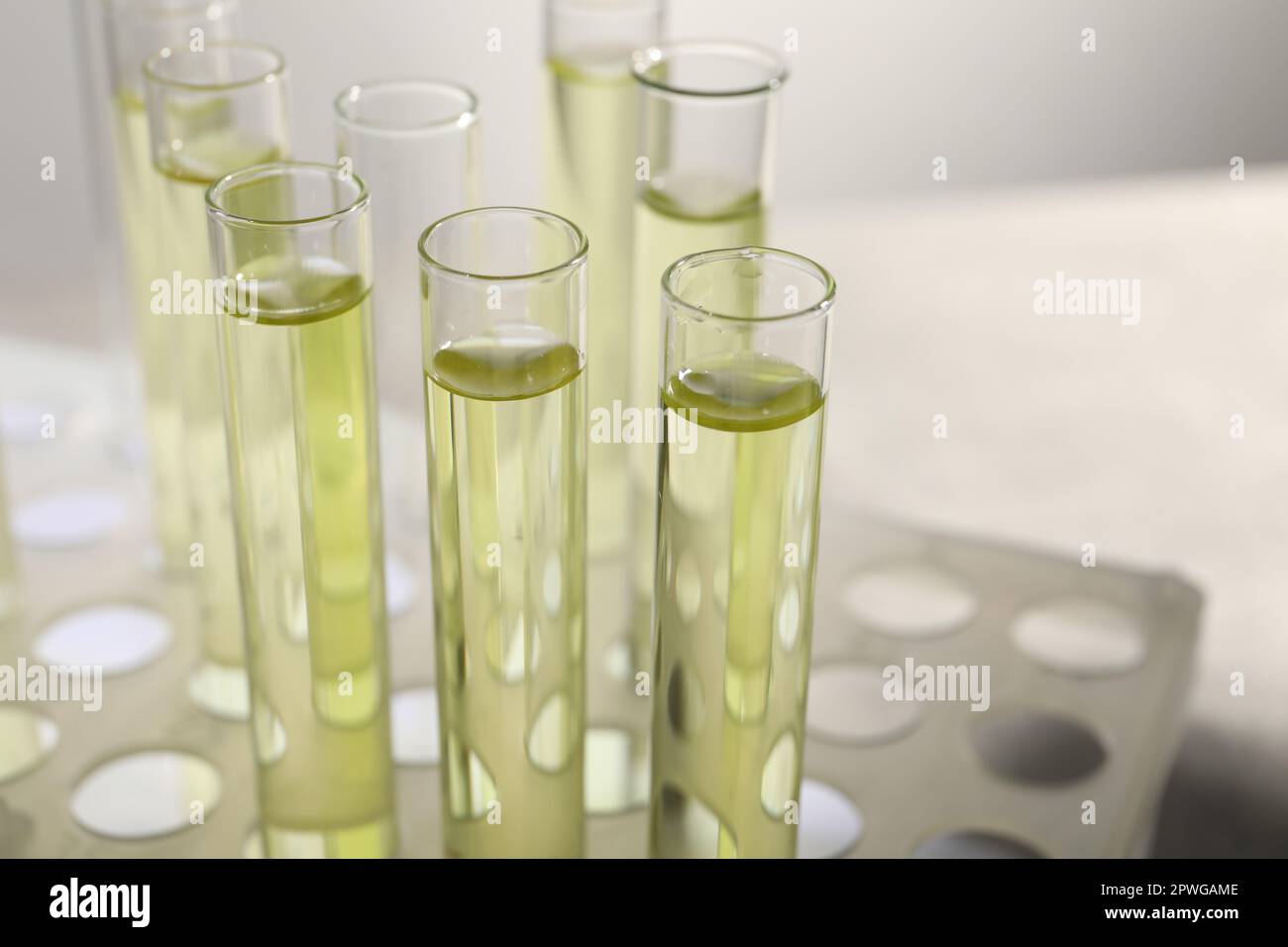 Test tubes with urine samples for analysis in holder on grey background ...
