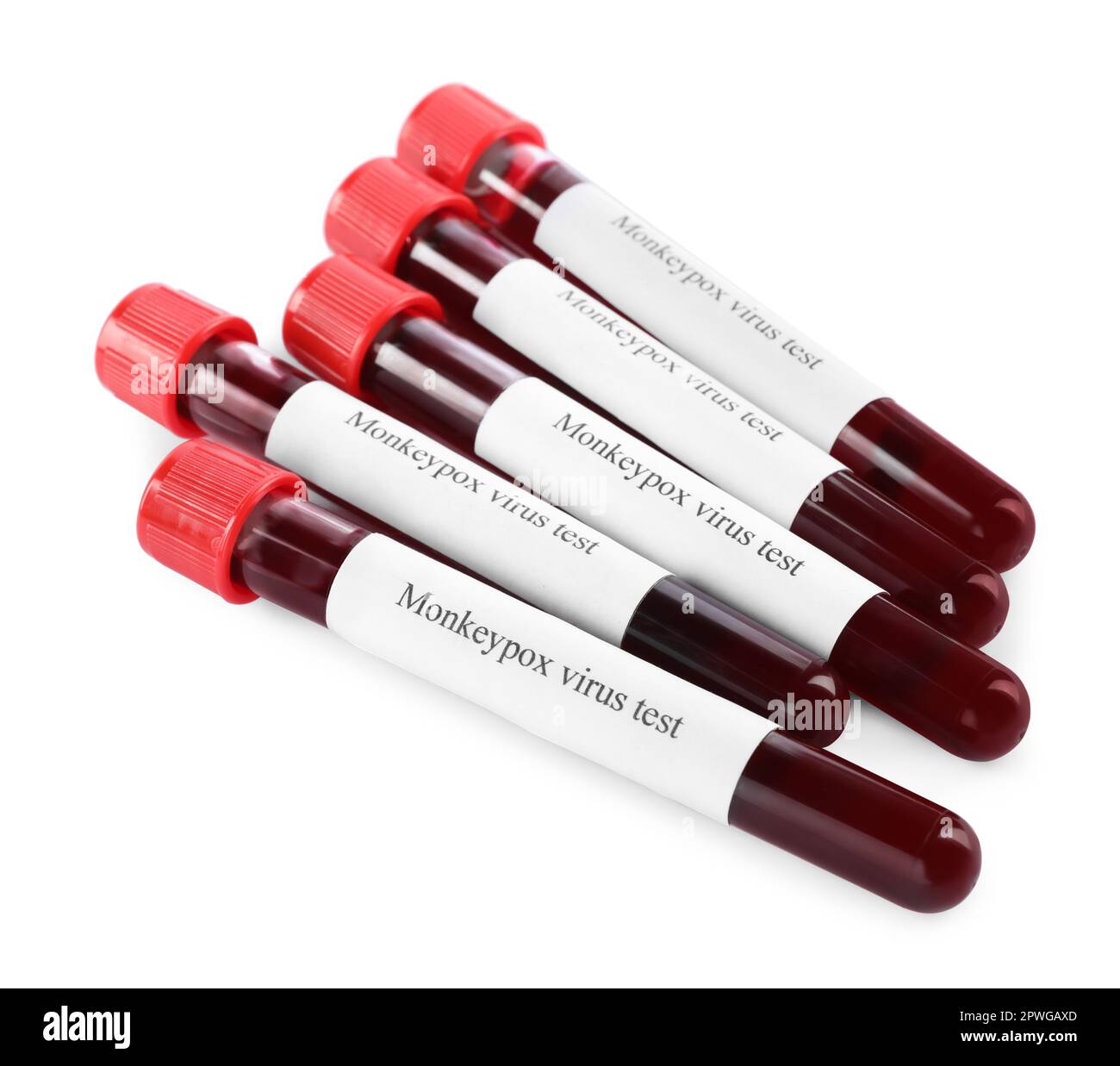 Monkeypox virus test. Sample tubes with blood on white background Stock ...