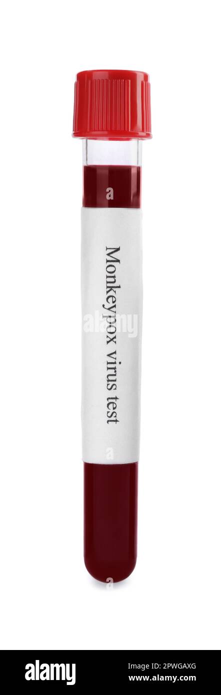Monkeypox virus test. Sample tube with blood on white background Stock ...