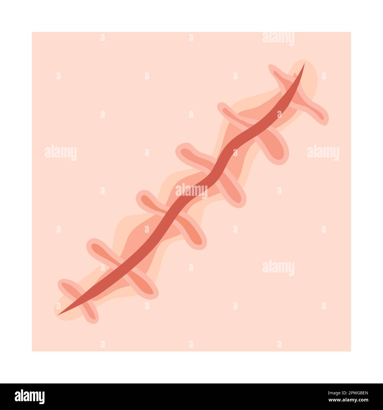 Scar cartoon illustration. Injures, scratches, bruises, surgical ...