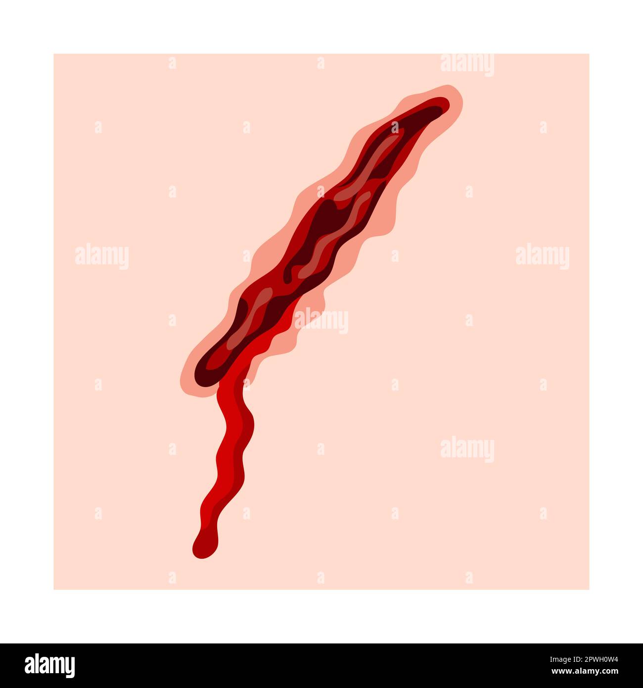 Skin scar with stitches cartoon illustration. Bloody wound, injures ...