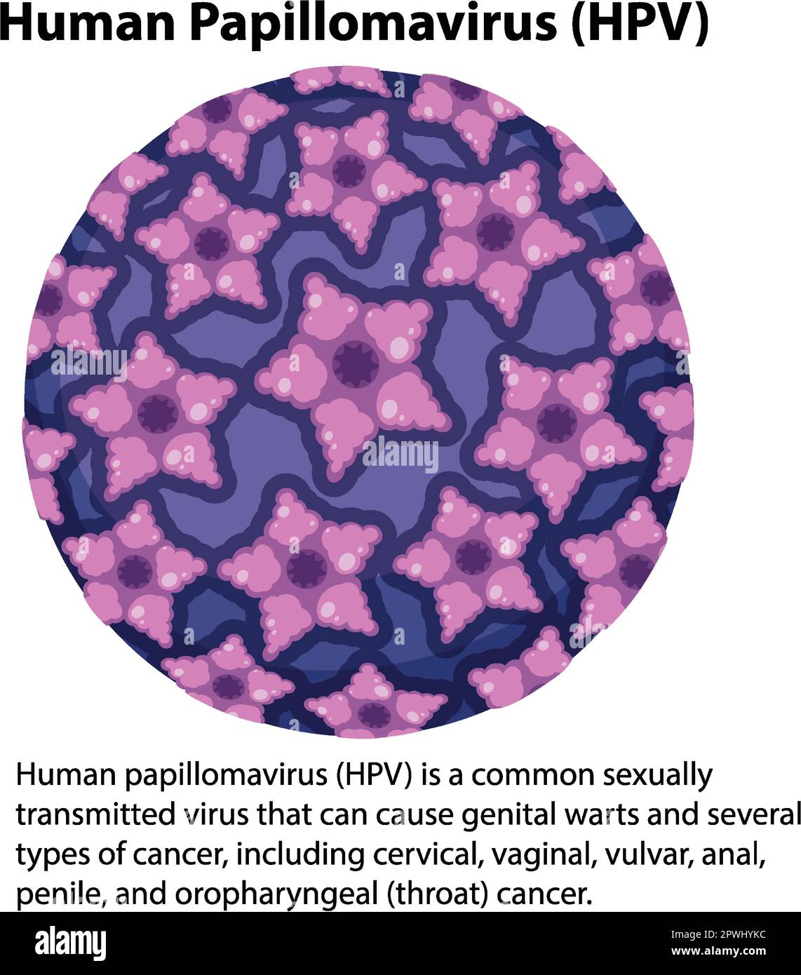 Human Papillomavirus with explanation illustration Stock Vector Image ...
