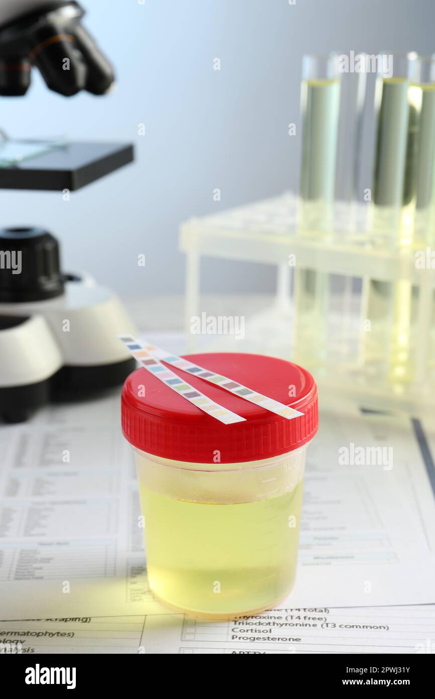 Container with urine sample for analysis on test forms in laboratory ...