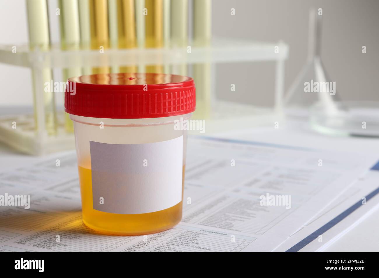 Container with urine sample on table, closeup. Space for text Stock ...