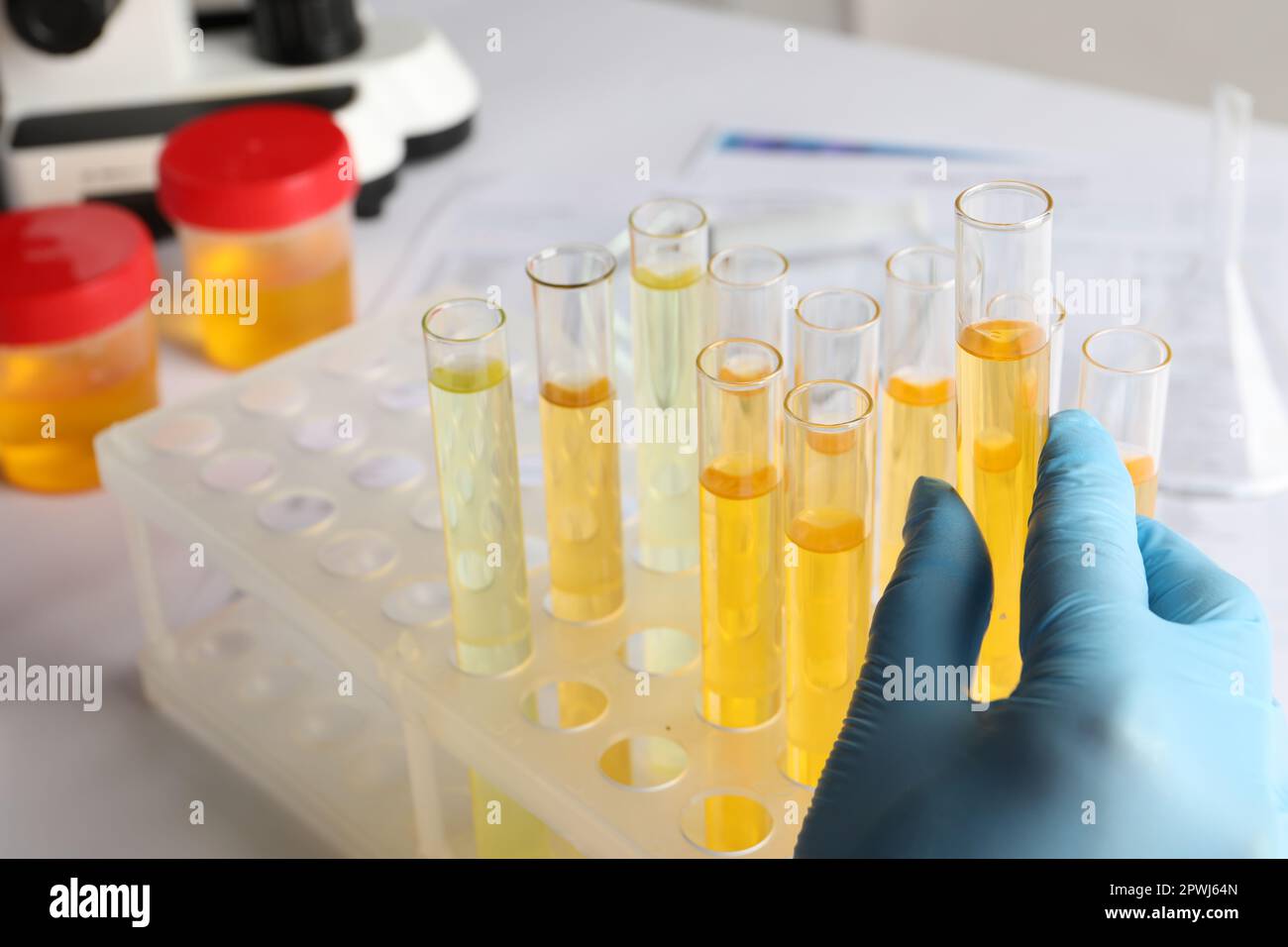 Nurse holding tube with urine sample at table, closeup. Specimen ...