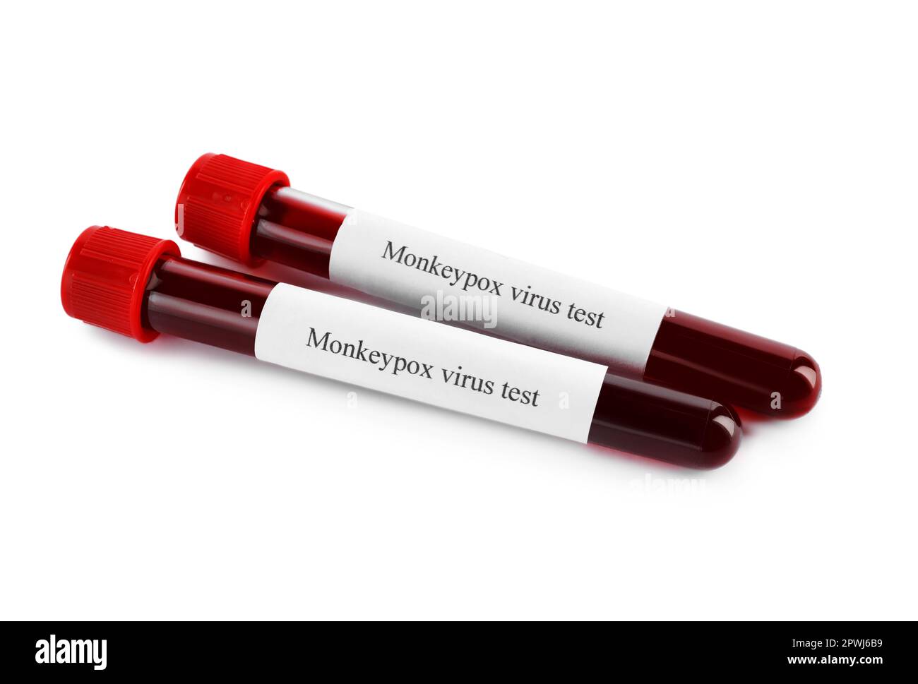 Monkeypox virus test. Sample tubes with blood on white background Stock ...