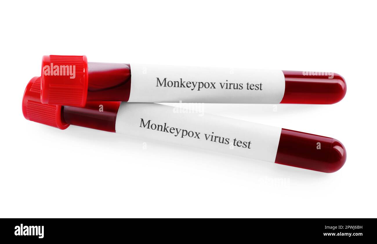 Monkeypox virus test. Sample tubes with blood on white background Stock ...