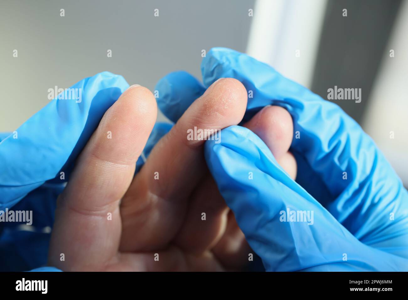 Checking condition skin hi-res stock photography and images - Alamy