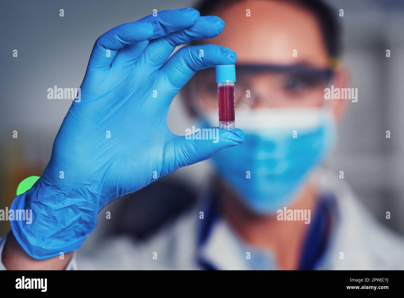 Blood vile hi-res stock photography and images - Alamy