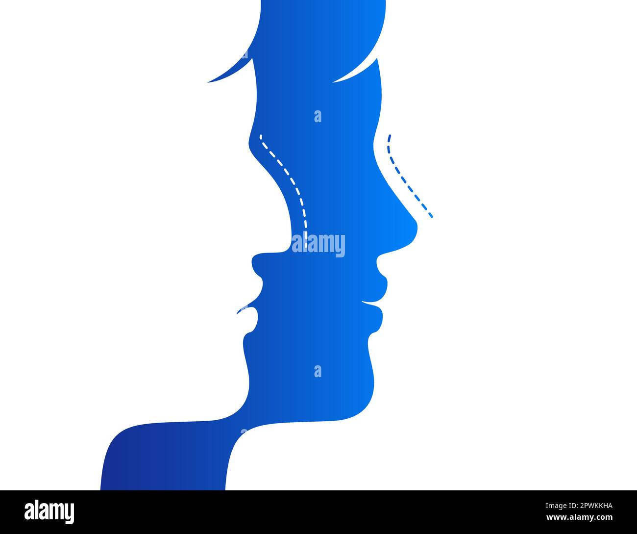 Woman with crooked and straight nose and different emotions. Nose ...